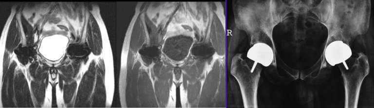 MARS MRI - Magnetic Resonance Spectroscopy in Mumbai, India | Picture This